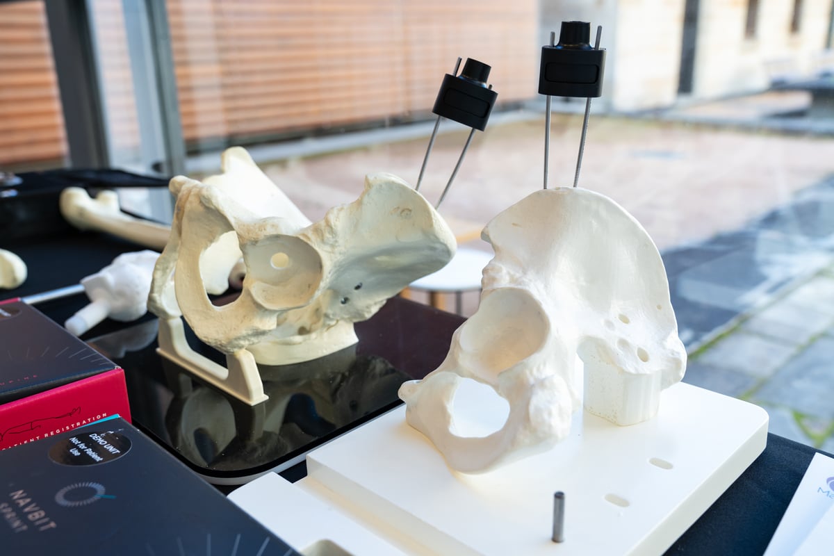 MatOrtho - Pioneers of next generation orthopaedic implant devices